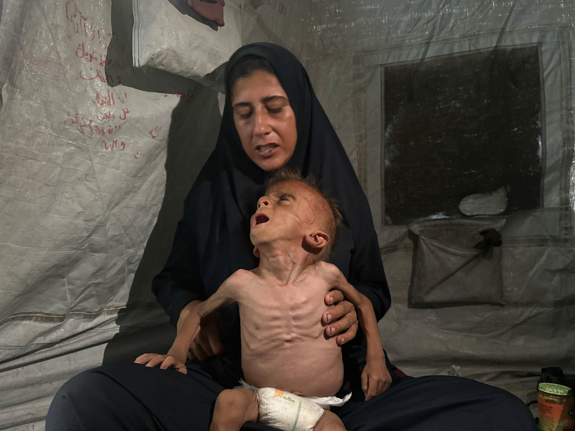 Enfermos y desnutridos, los niños de Gaza que Israel llama 'fake news ...